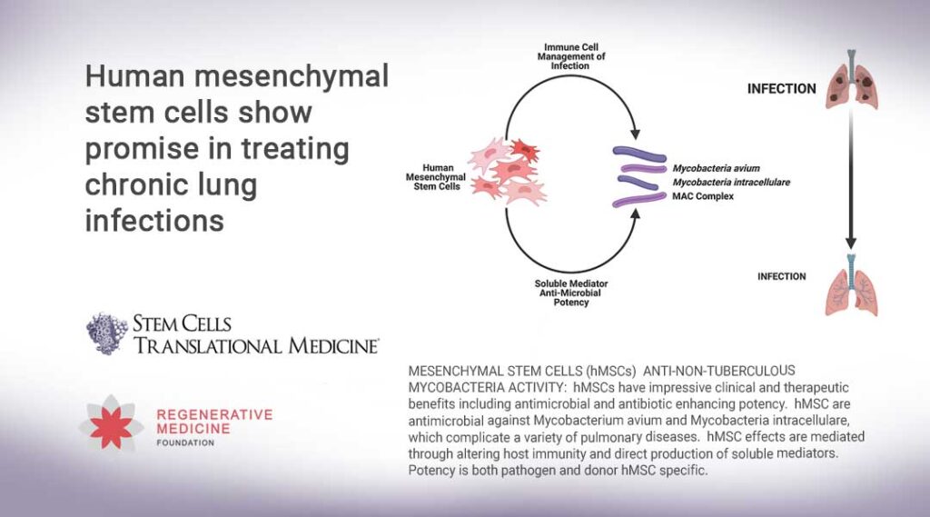 Human mesenchymal stem cells show promise in treating chronic lung ...
