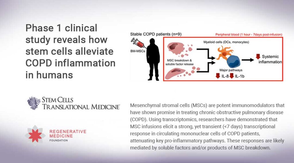 Phase 1 clinical study reveals how stem cells alleviate COPD ...