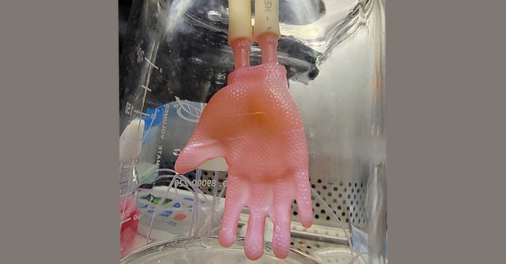 Engineering skin grafts for complex body parts | Regenerative Medicine ...